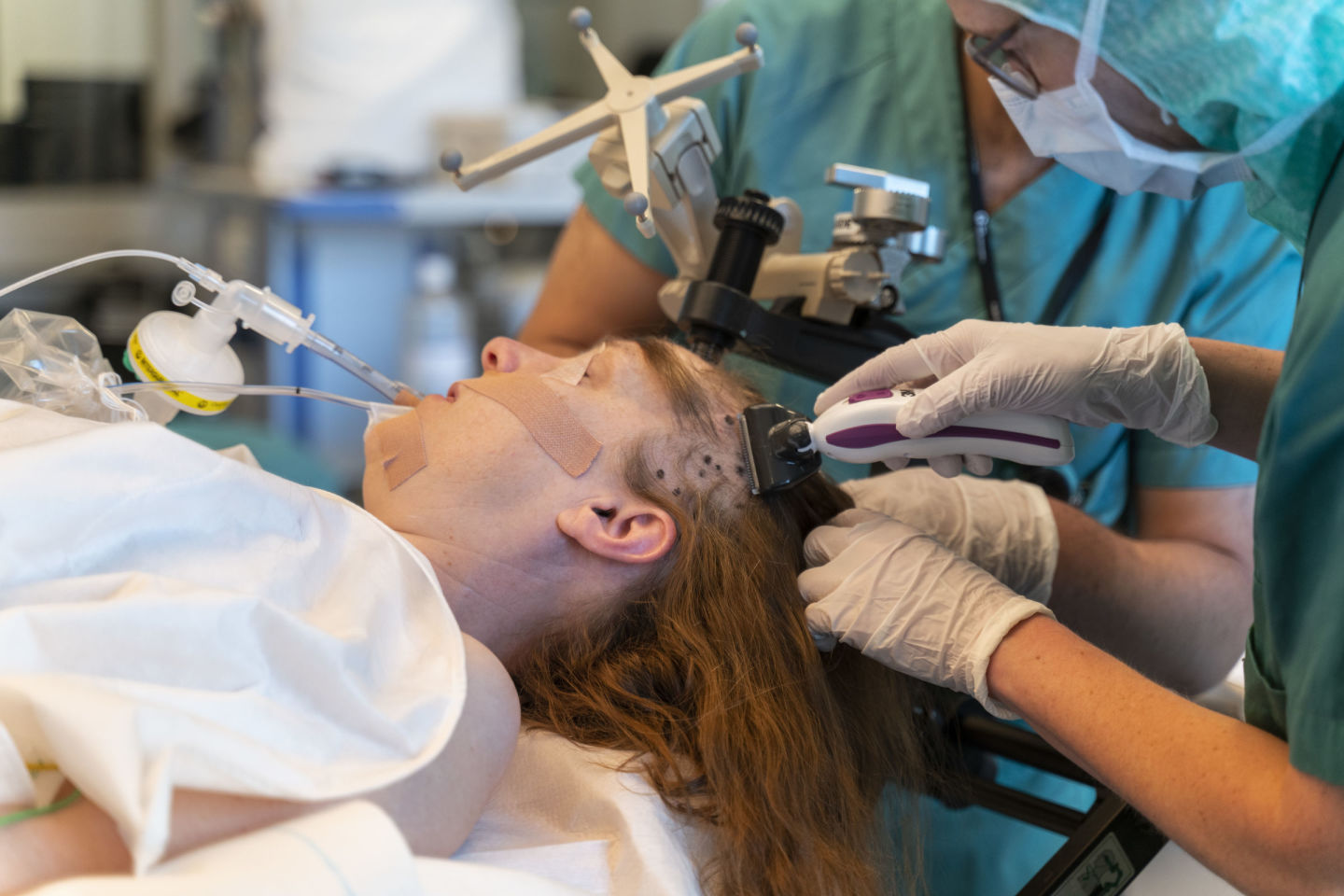 På innsiden under epilepsikirurgi | Aktuelt | Epilepsiforbundet